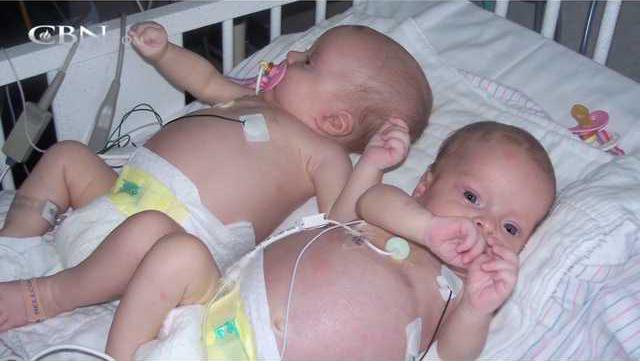 Doctor notices this babys belly is growing strangely; when he examines ...